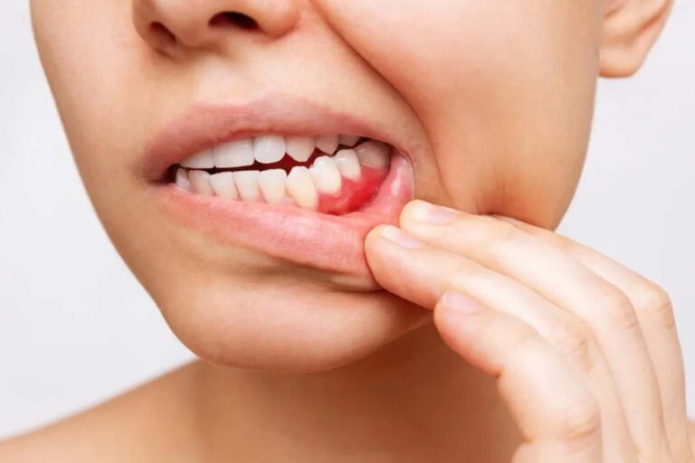 5 Signs Your Dental Bridge Don't Fit Properly - Hampton Village Dentistry